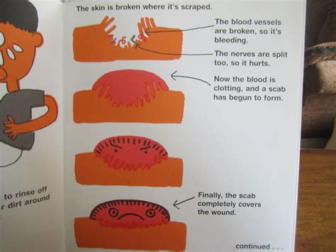 Scabs Go Go Gadget Zen