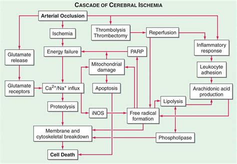 10 Effective Ischemic Stroke Treatment Protocols What You Should Know