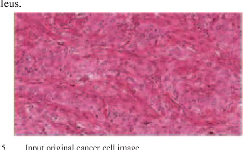 Figure 1 From Cancer Diagnosis Using Automatic Mitotic Cell Detection And Segmentation In