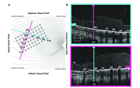 OCT Data From Participant S A Schematic Showing The Estimated Download Scientific Diagram