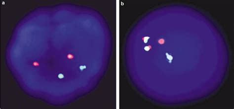 A Representative Nuclei From Reactive Tonsil Hybridized With Dual