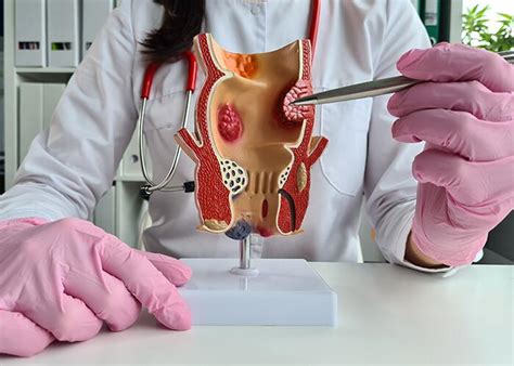 Submucosal Fibroids Fertility And Heavy Bleeding