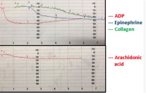 Formulas Flashcards Quizlet