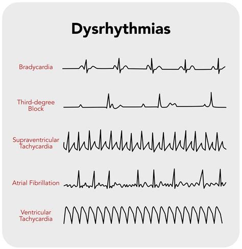 Interpreting A 12 Lead Electrocardiogram 12 Lead Ecg Resources Acls Certification Association