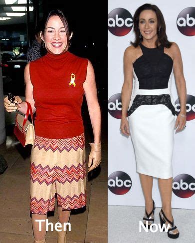 Patricia Heaton Plastic Surgery Before And After Photos Artofit