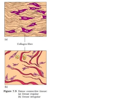Dense Irregularconnective Tissue