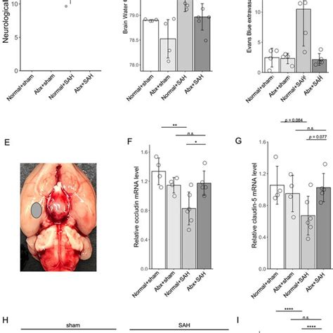 Manipulating The Gut Microbiome Ameliorates Ebi A The Experimental