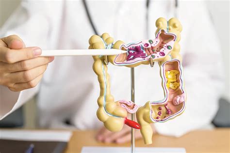 سندروم روده تحریک پذیر چیست؟ آشنایی با بیماری Ibs لبنیات کالین