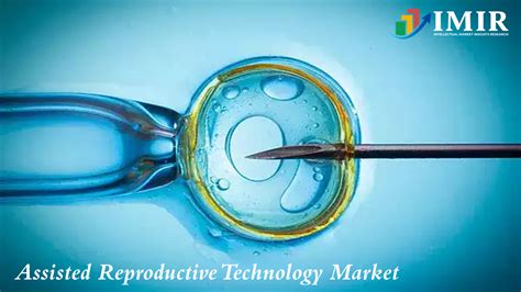 Assisted Reproductive Technology Market Trends New Innovations Comes In The Market
