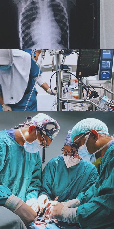 Navy Laksmono On Linkedin We Did A Vsd Closure And Pda Ligation On A 5 Y O Female With Down…