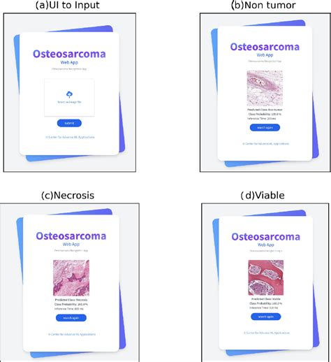 Figure 9 From A Novel Hybrid Approach For Classifying Osteosarcoma Using Deep Feature Extraction