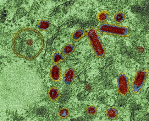 Rabies Virus Cell Culture