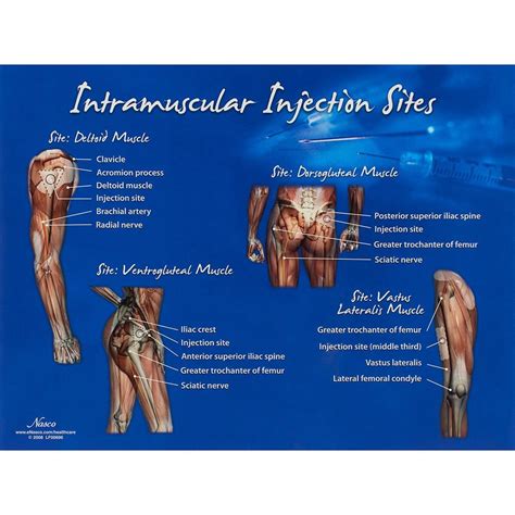 Anatomy Trainer Intramuscular Injection Sites Chart