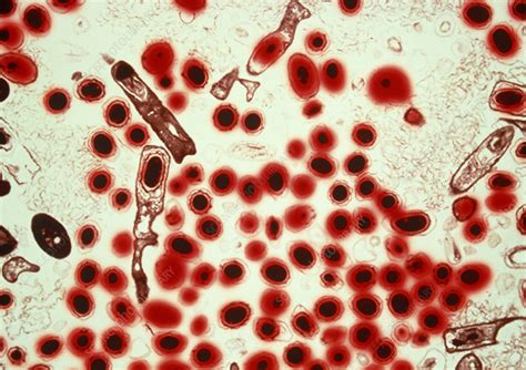 What Are Anthrax Spores At Savannah Mccarthy Blog