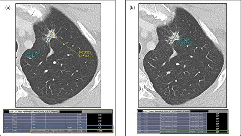 Figure 2 From Augmented Radiologist Workflow Improves Report Value And