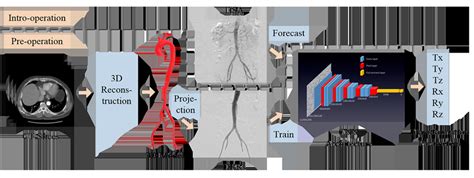 Framework Of 2d 3d Registration By Cnn Regression Download Scientific Diagram