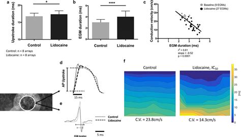 Effects Of Lidocaine On Action Potential Upstroke Electrogram Duration Download Scientific