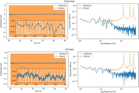 Real Data Example Stimulation Artefacts In Human Ecog Data — Pyparrm 1 1 1 Documentation