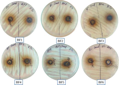 Antibacterial Activity Of Crude Methanolic Seed Extracts Of 50 Mgml