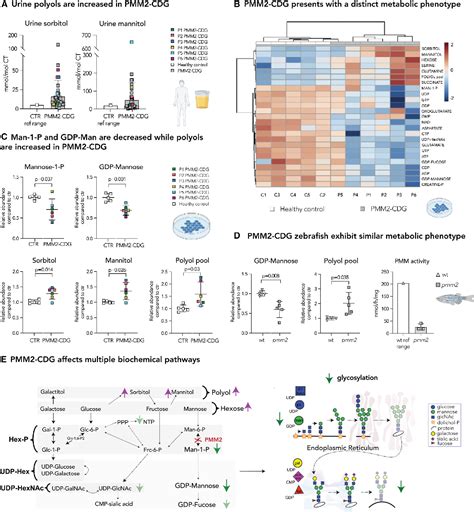Figure 1 From Tracer Metabolomics Reveals The Role Of Aldose Reductase