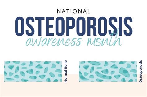 National Osteoporosis Awareness Month Marsha Fenwick Nutrition