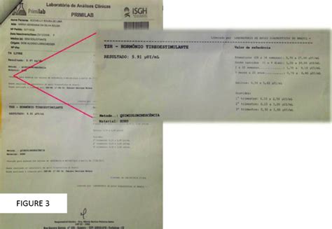 Patients Report Of Serum Tsh Levels Download Scientific Diagram