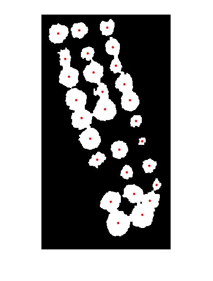 Image Segmentation Matlab Stack Overflow
