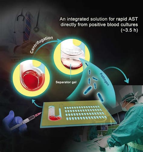 Microfluidic Chip Tests Drug Sensitivity Medical Design Briefs