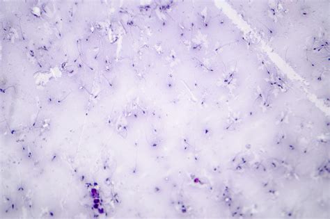 Research Shows A Significant Sperm Count Decline Globally