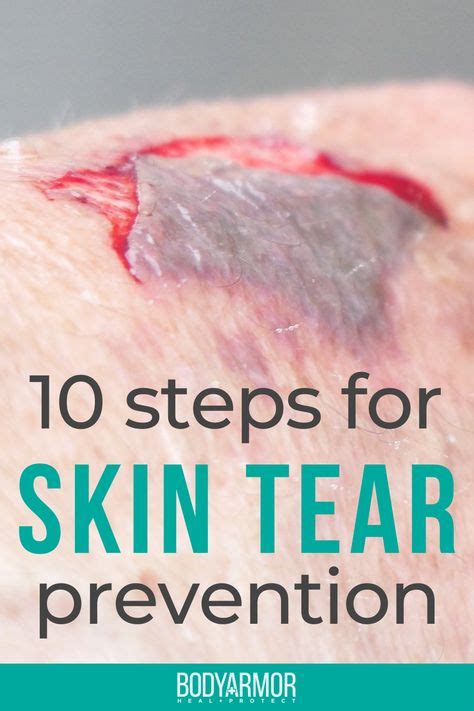 34 Wound Care Fair Ideas In 2025 Wound Care Wound Care Nursing