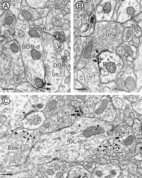 Electron Micrographs Showing Dor Li In Dendrites And Their Relationship