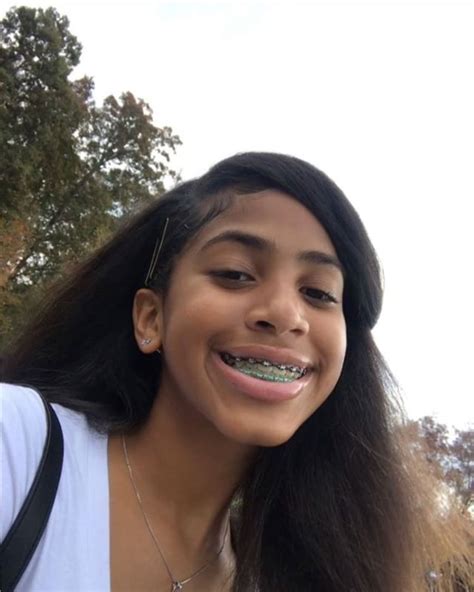 Braces Cost In Puerto Rico At Megan Mildred Blog