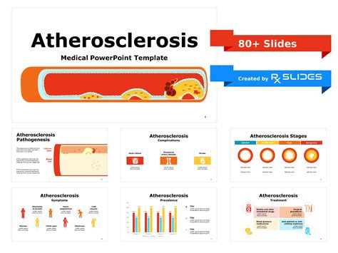 Download Atherosclerosis Powerpoint Template Rxslides