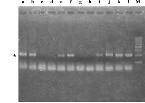 Detection Of Bacteria In Bacterial Culture Broth Using Two Step Method Download Scientific