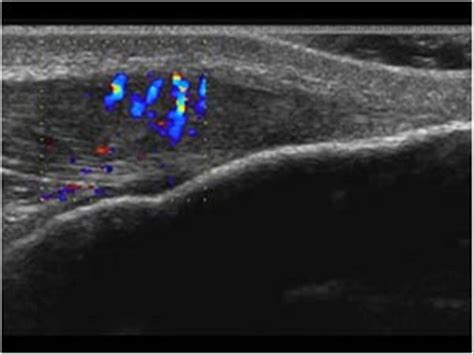 Musculoskeletal Joints And Tendons 66 Knee Case 663 Patellar