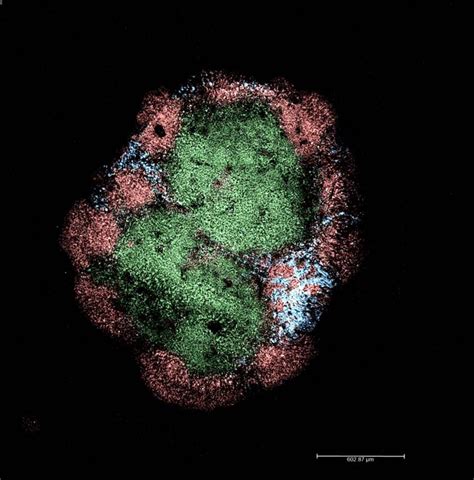Biodistribution Of Nanoparticles In A Lymph Node Ki Image Awards Archive