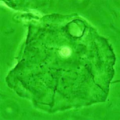 Adhered Streptococci To A Buccal Epithelial Cell Download Scientific