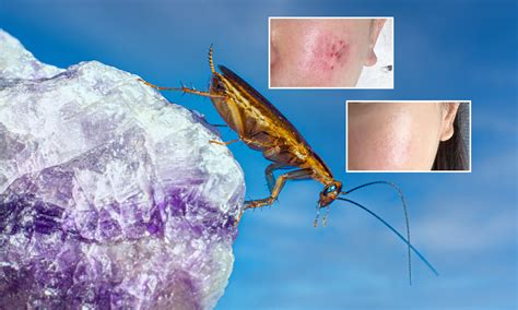 Influencer Claims Putting Cockroach Juice On Her Face Cur