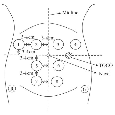 A Toco And B Ehg Signals From A Pregnant Woman In Term Labor Download Scientific Diagram