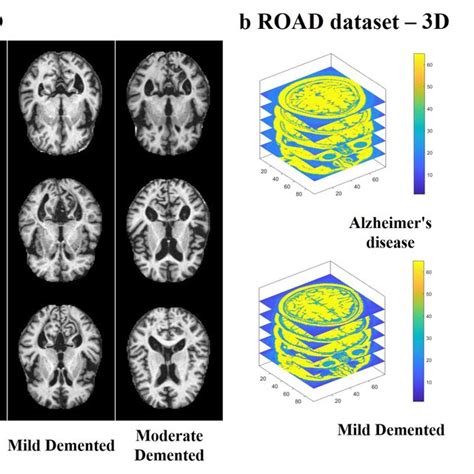 Examples Of Multi Modal Data A Magnetic Resonance Imaging Mri
