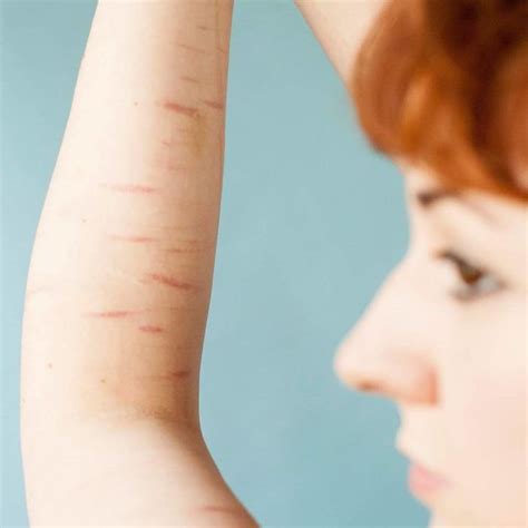 People Reveal Their Scars And How They Got Them In A Powerful Photo Project Bored Panda