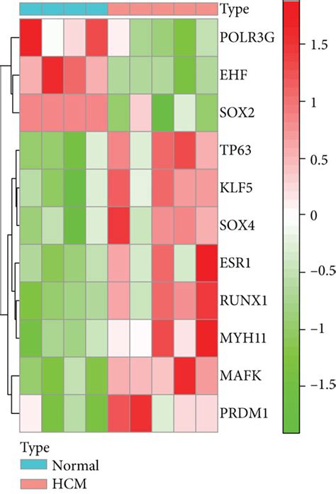 Tf Regulatory Network A The Differentially Expressed Tfs Between Hcm