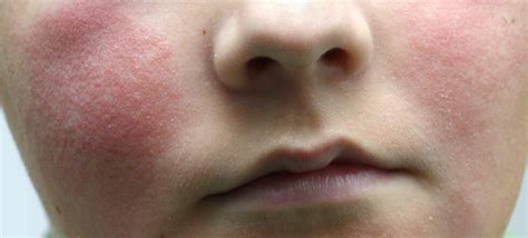 Barnesykdommer Kk No