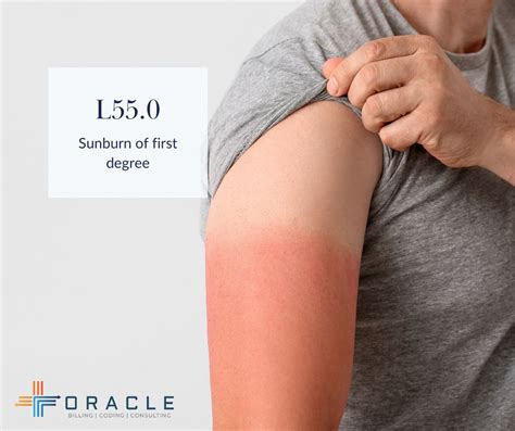 Oracle Billing Coding And Consulting On Linkedin This Summer Practice Sun Safety So You Dont