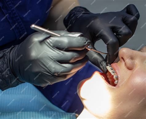 Premium Photo Woman With Braces Visits An Orthodontist In A Dental Chairduring The Procedure