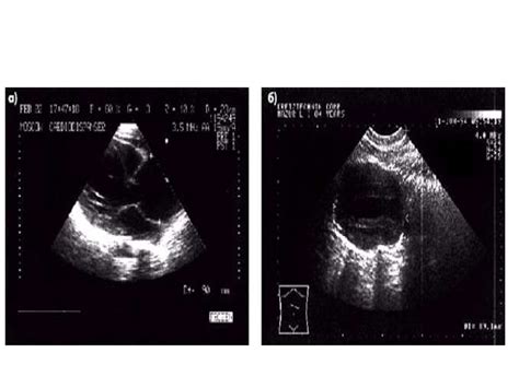 Ультразвуковое исследование сосудов презентация онлайн