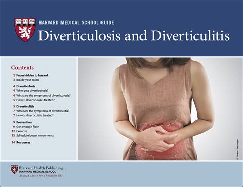 Diverticulitis