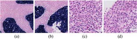 Examples Of Eber And Hande Images Ab Are Examples Of Eber Staining Download Scientific