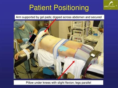 Ppt Laparoscopic Partial Nephrectomy Equipment And Technique Guide
