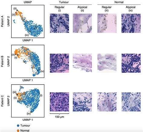 Integration Of Spatial Transcriptomics And Histology Images By Joey